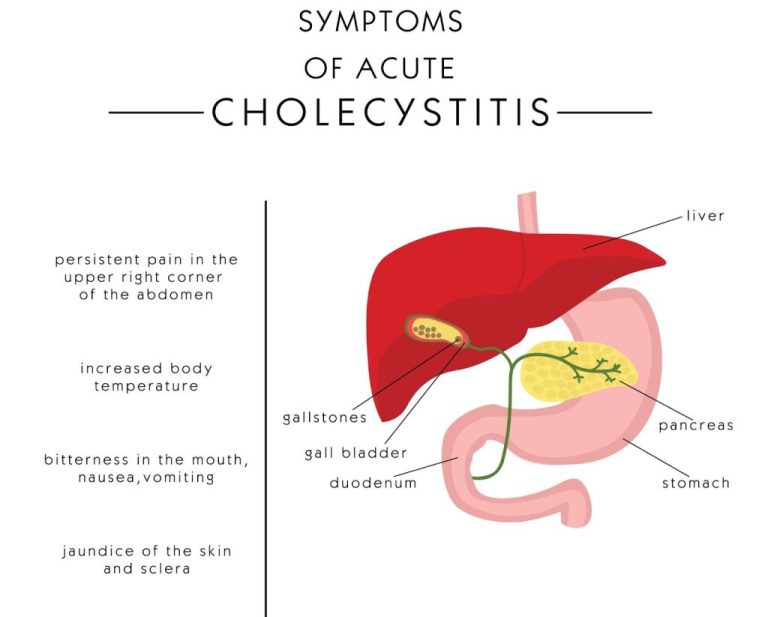 Cholecystitis Symptoms, Tests, and Treatment | ACE Specialist Clinic
